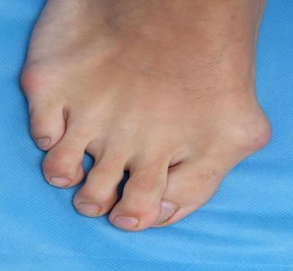 Orthopädie | Department Hand & Fuß